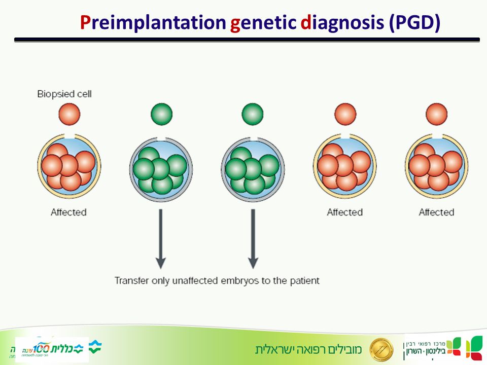 Preimplantation Genetic Diagnosis Sex Selection Bbw Ebony Shemales