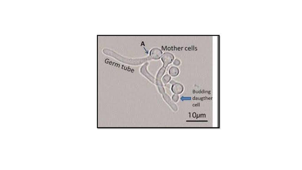 Candida Albicans Microscope Slide