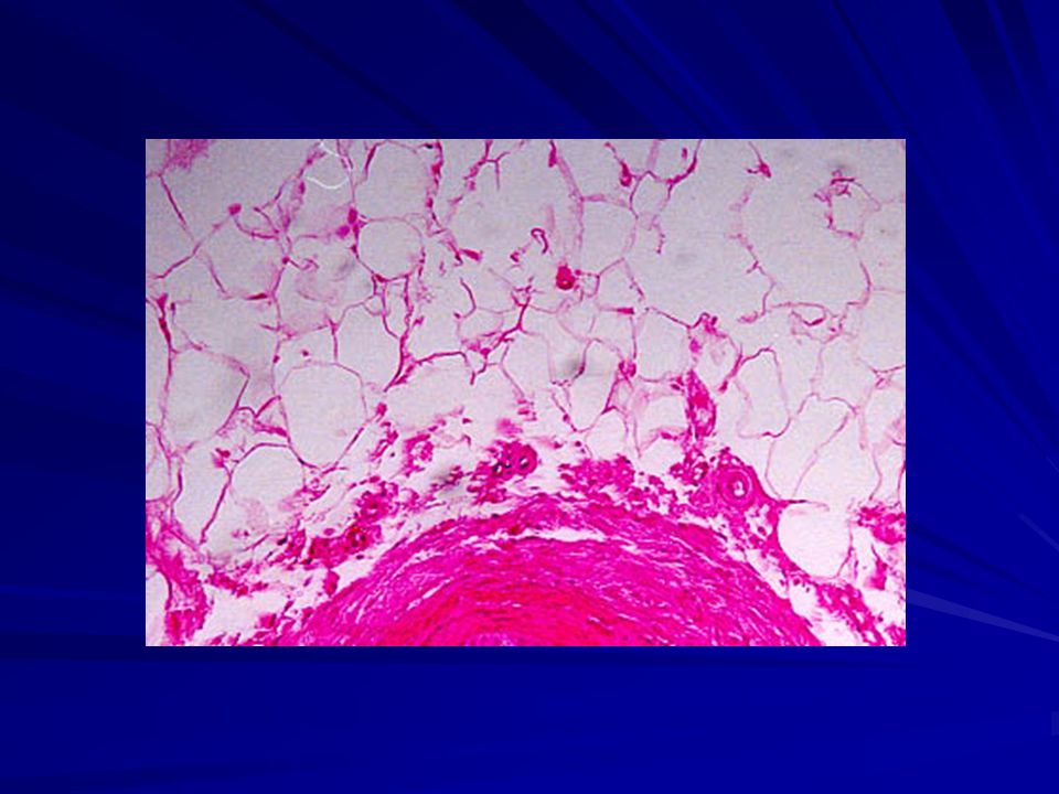 Adipose Tissue Slide