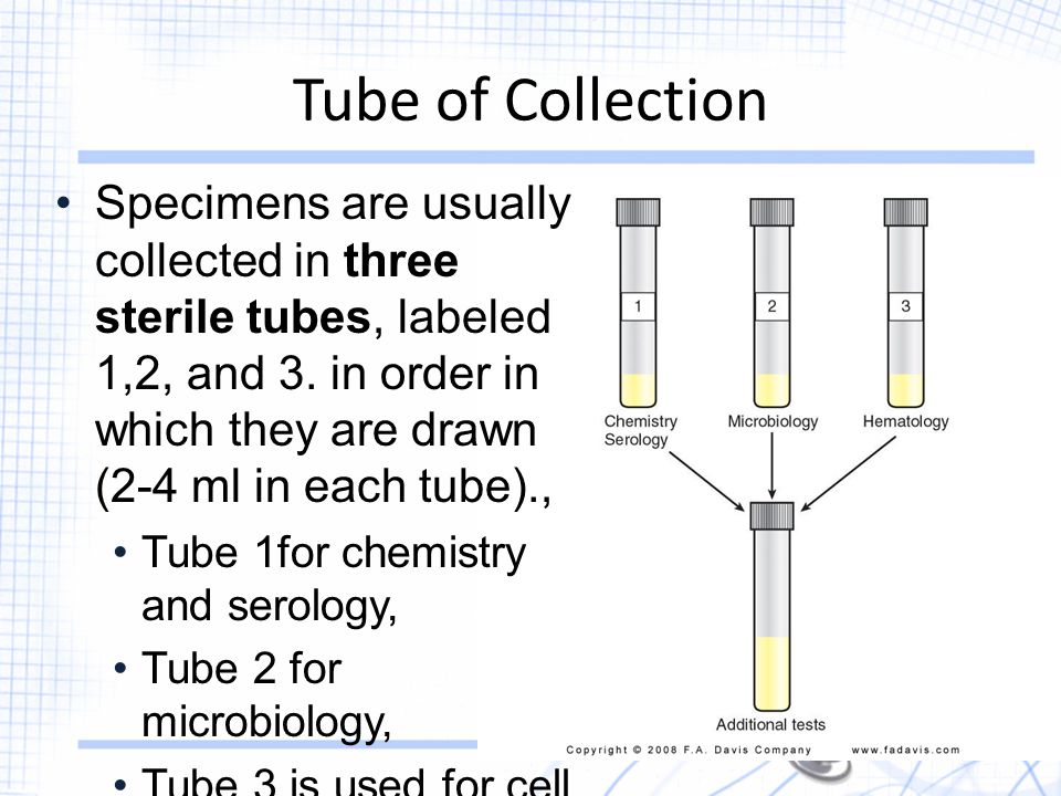 Cerebrospinal Fluid Analysis:- Part Cerebrospinal Fluid, 58% OFF Cerebrospinal Fluid Analysis:- Part Cerebrospinal Fluid, 58% OFF