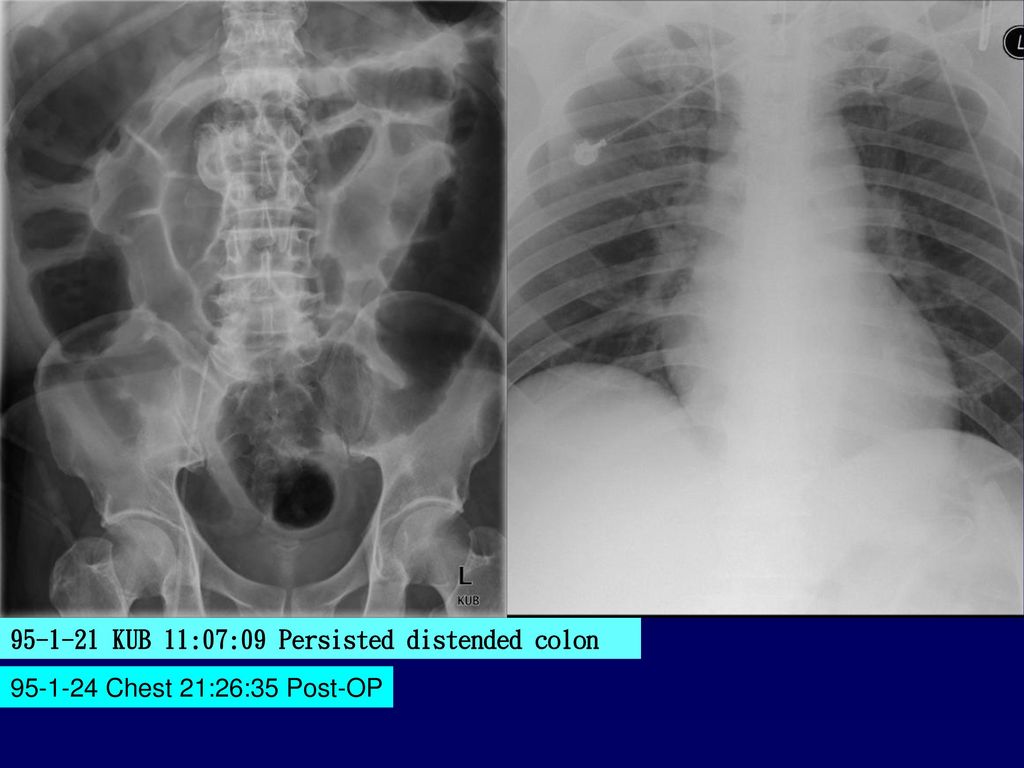 Gi Radiology Case 1 陳x貞 45 Year Old Female Ppt Download