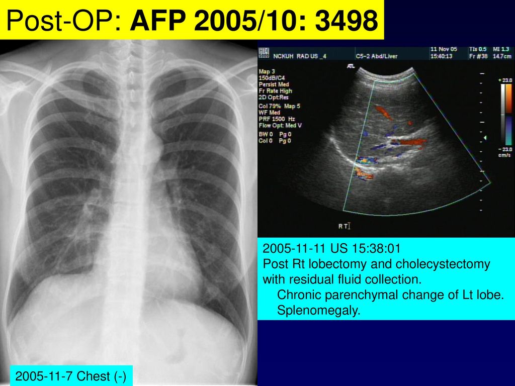 Gi Radiology Case 1 陳x貞 45 Year Old Female Ppt Download
