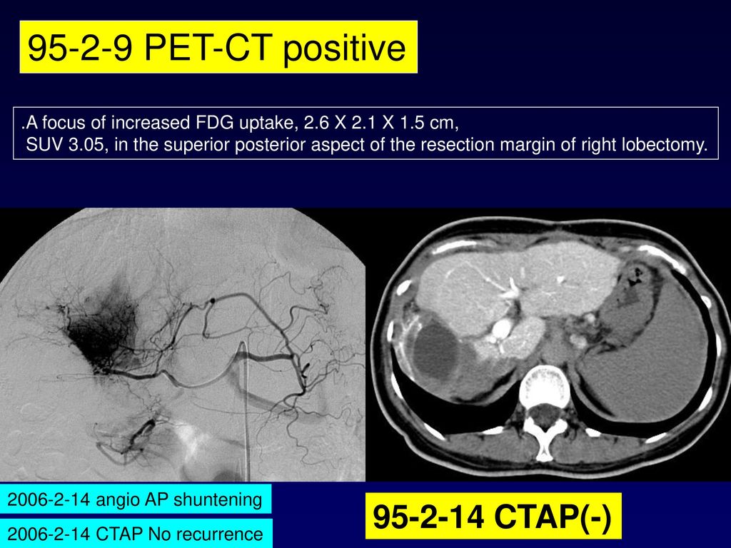 Gi Radiology Case 1 陳x貞 45 Year Old Female Ppt Download