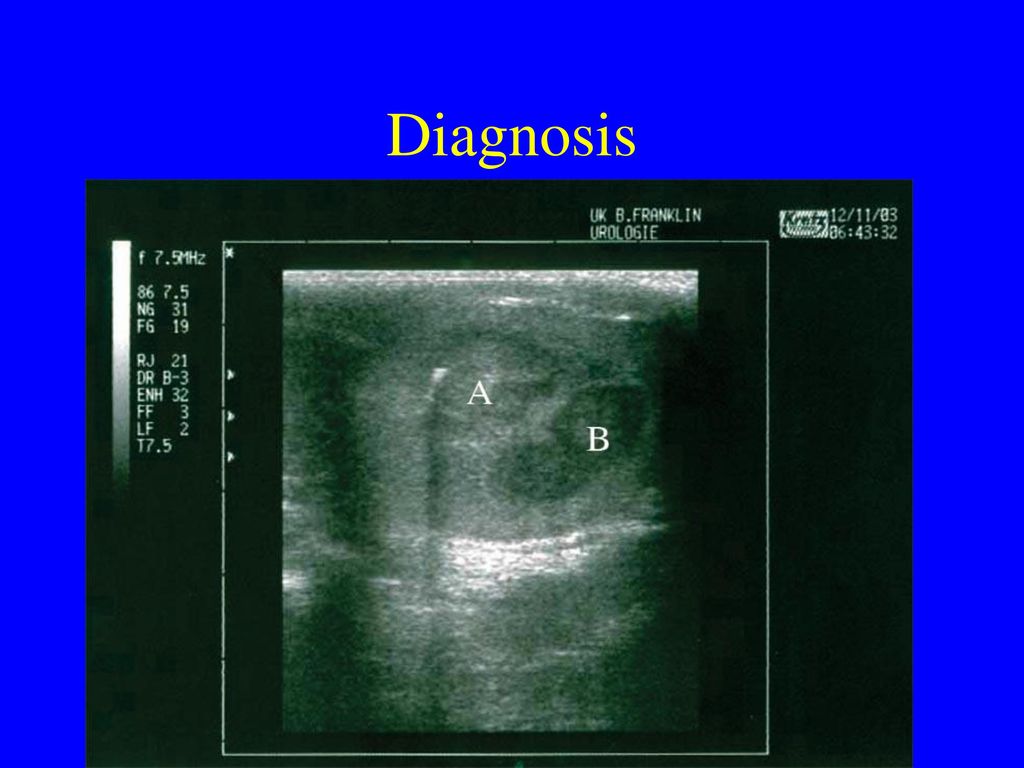 Christopher Saigal Md Mph Associate Professor Ucla Dept Of Urology