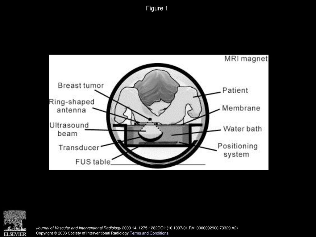 Feasibility Of Magnetic Resonance Imaging Guided Focused Ultrasound