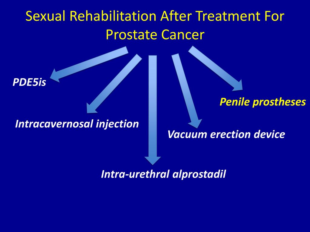 Ateş Kadıoğlu Md Fecsm Professor Of Urology University Of Istanbul