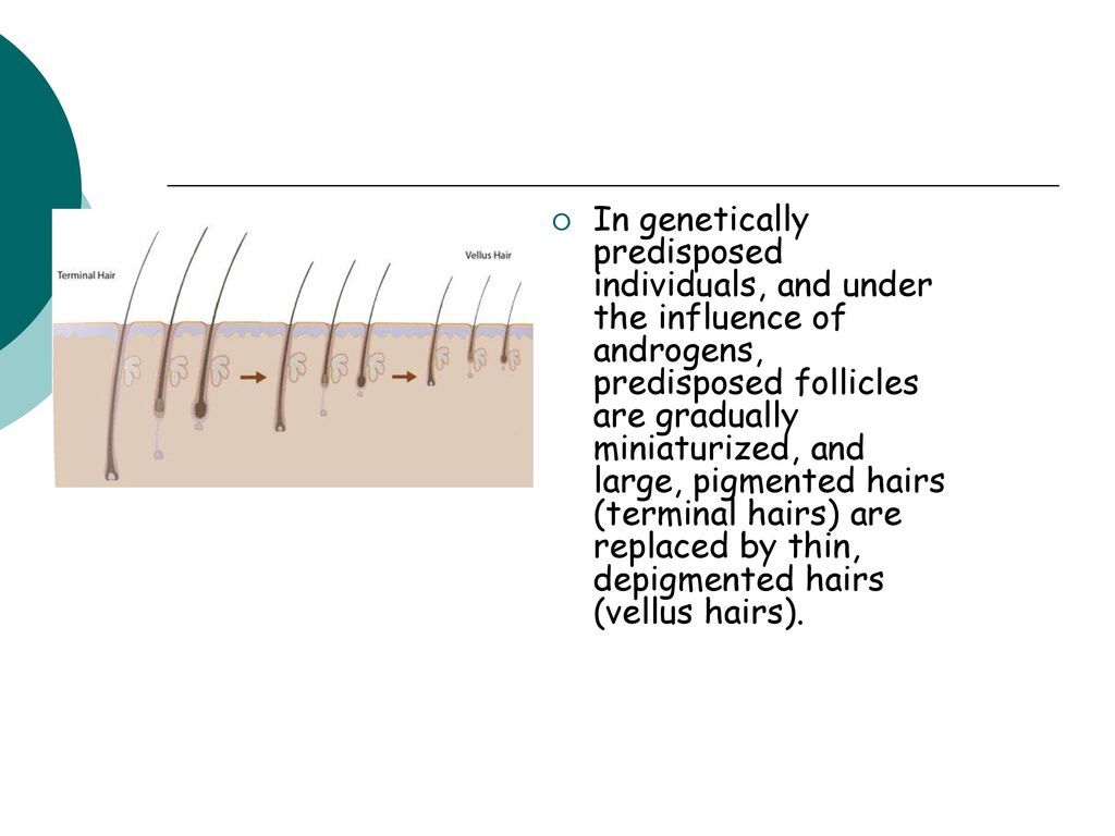 Types Of Haİr Lanugo Hair Soft Fine Hair That Covers Much Of Fetus Usually Shed Before Birth