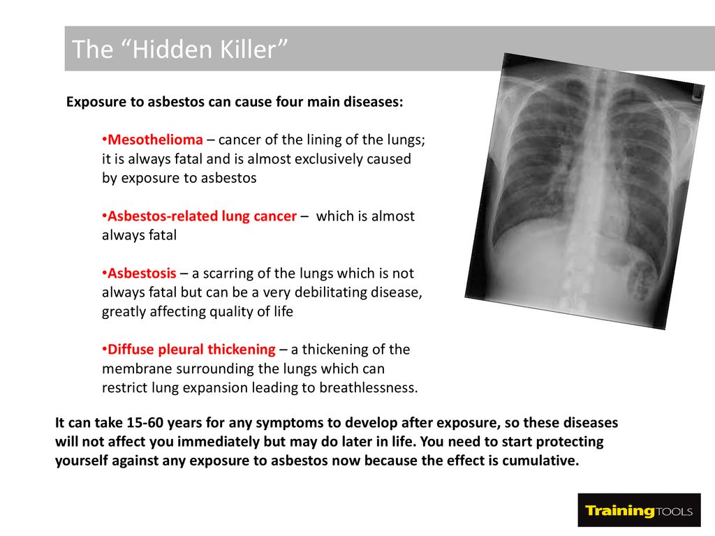 Identifying Asbestos Ppt Download