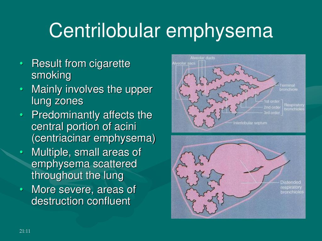 Imaging Pattern Of Respiratory Disease Ppt Download