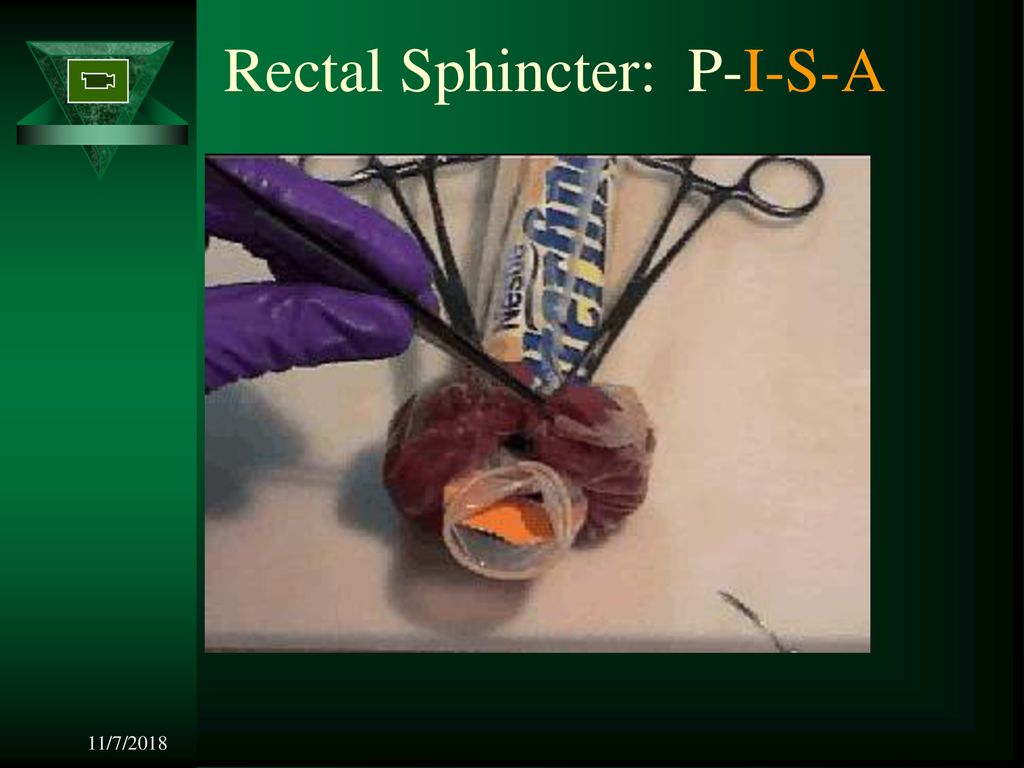 Perineal Repair Workshop Ppt Download