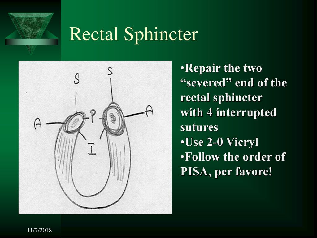 Perineal Repair Workshop Ppt Download