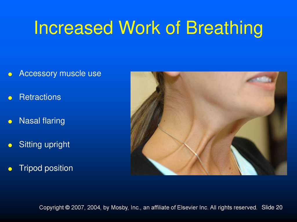 What Is Retraction Breathing at Laura Conn blog What Is Retraction Breathing at Laura Conn blog