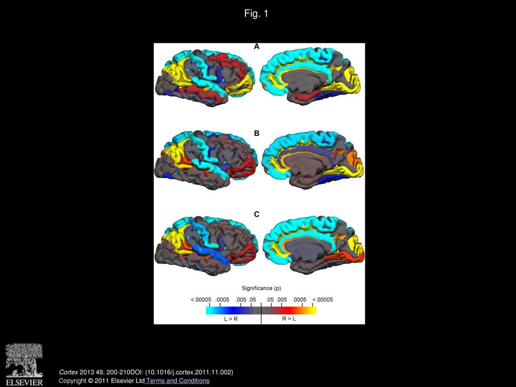 Hemispheric Asymmetries Of Cortical Volume In The Human Brain Ppt