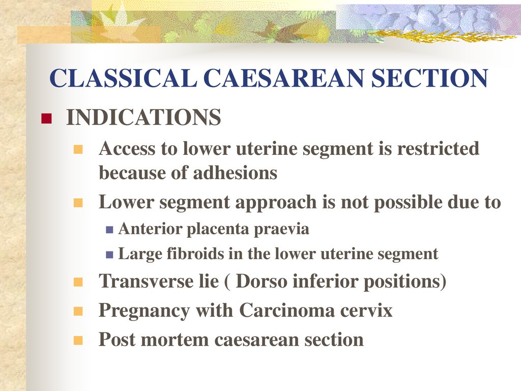 Caesarean Section Ppt Download