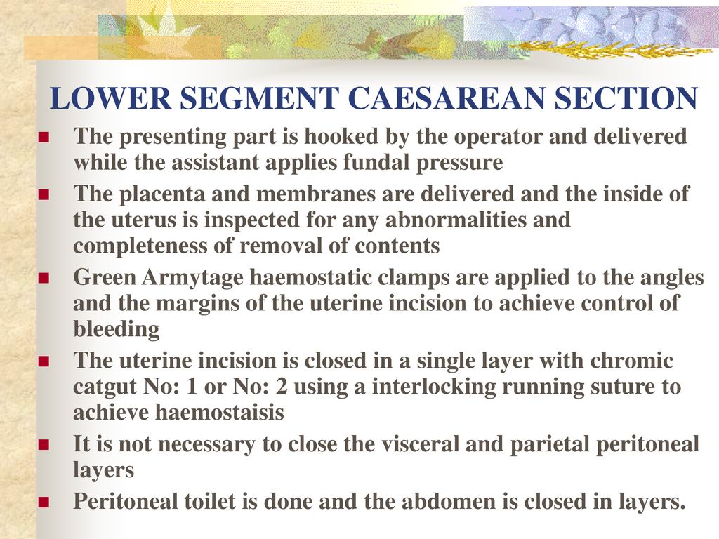Caesarean Section Ppt Download