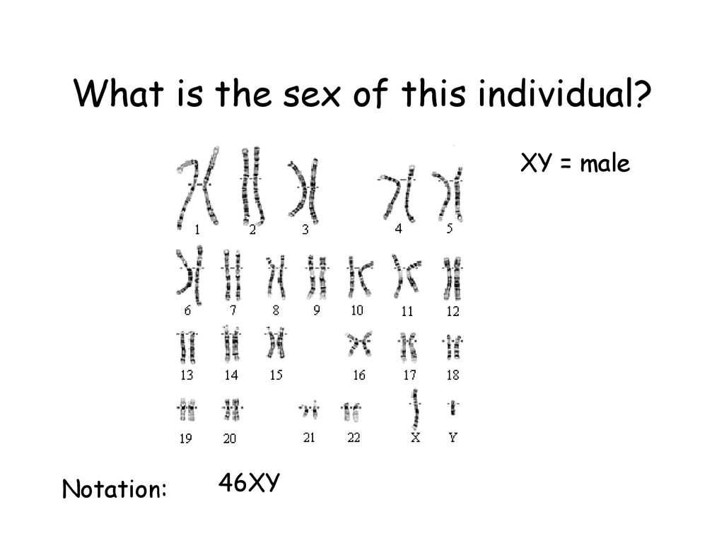 Karyotype A Chart Of Chromosome Pairs Arranged By Length And Location