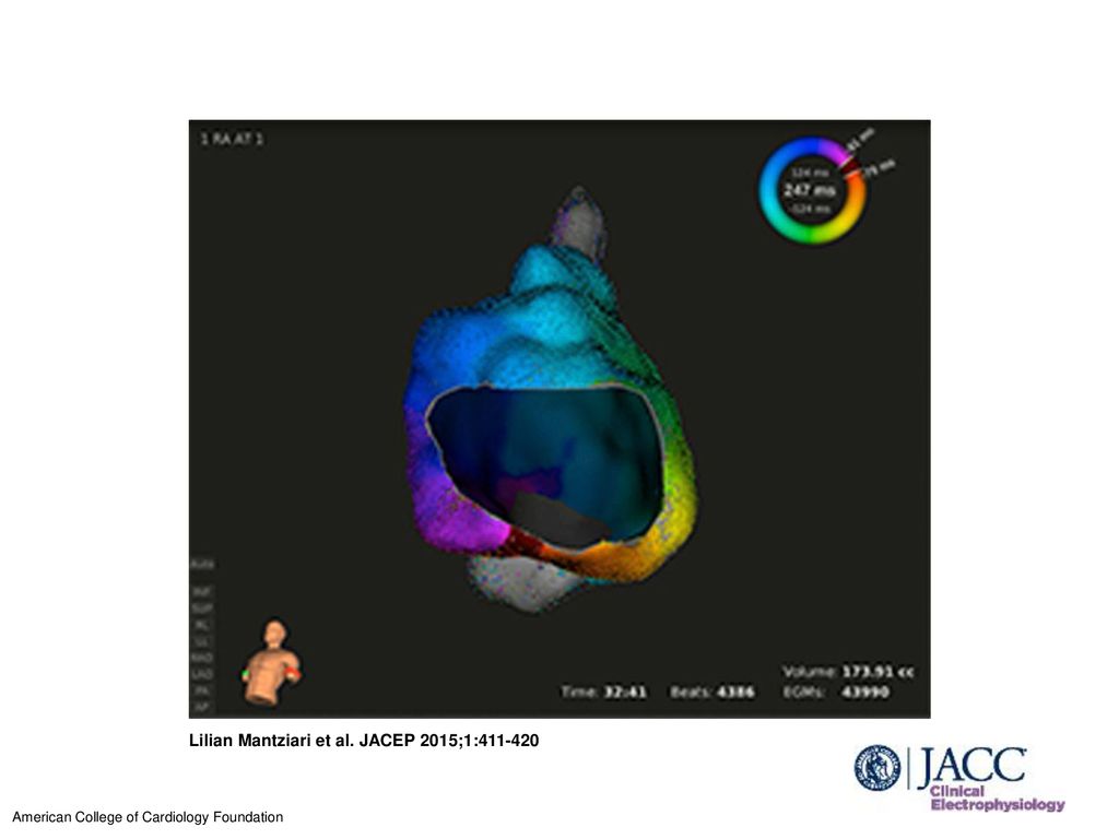 Lilian Mantziari Et Al Jacep 2015 1 Ppt Download