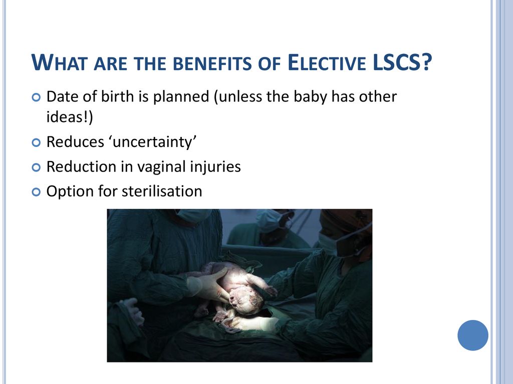 Birth After Caesarean Making Your Decision Ppt Download