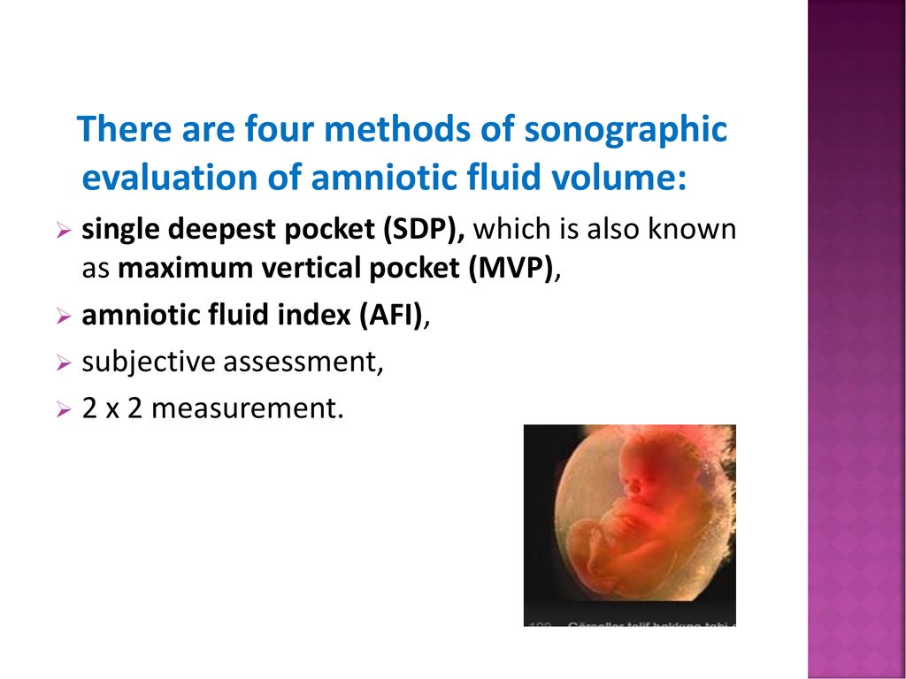 Amniotic Fluid Disorders Ppt Download