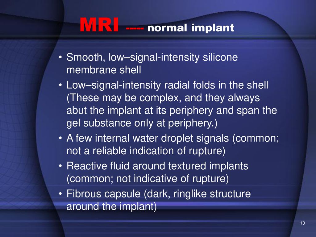 Cases Dr Payal Damor R2 Radio Diagnosis S S G H Baroda Ppt Download
