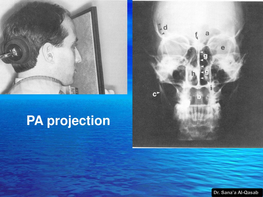 Extraoral Radiographic Techniques Ppt Download