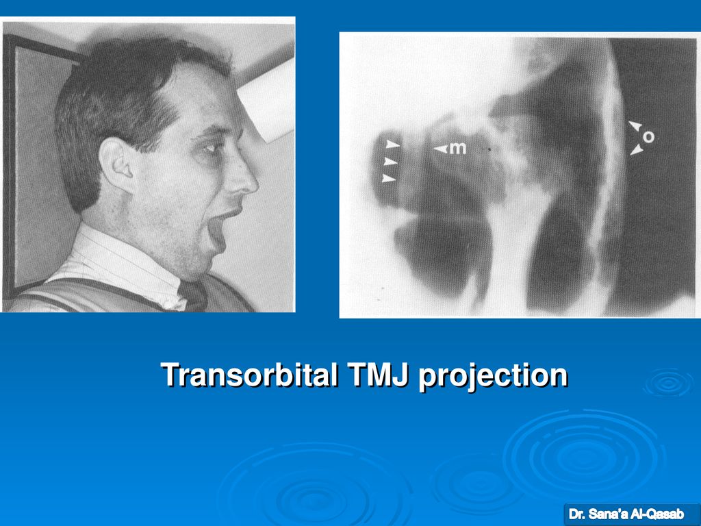 Extraoral Radiographic Techniques Ppt Download