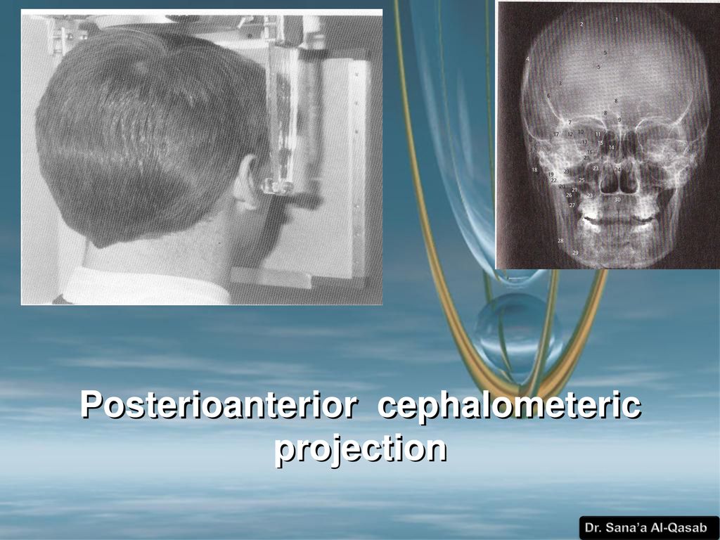Extraoral Radiographic Techniques Ppt Download