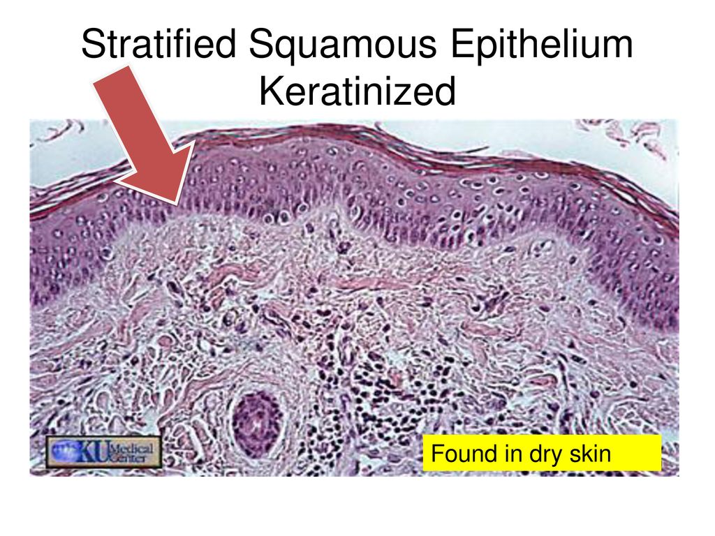 Stratified Squamous Epithelium Keratinized Skin Stratified Squamous Epithelium Keratinized Skin