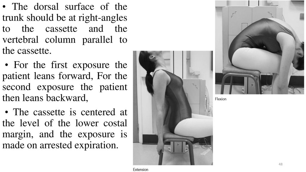Radiographic Technique Of Thoracic And Lumber Spine Ppt Download