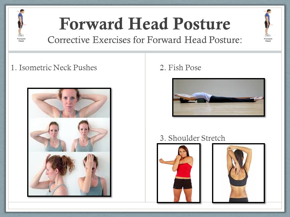 Forward Head Posture Exercises Correcting