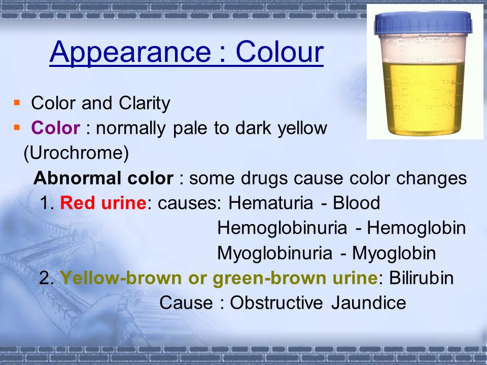 Summary Urine Normal Values, Their Significance, 55% OFF Summary Urine Normal Values, Their Significance, 55% OFF