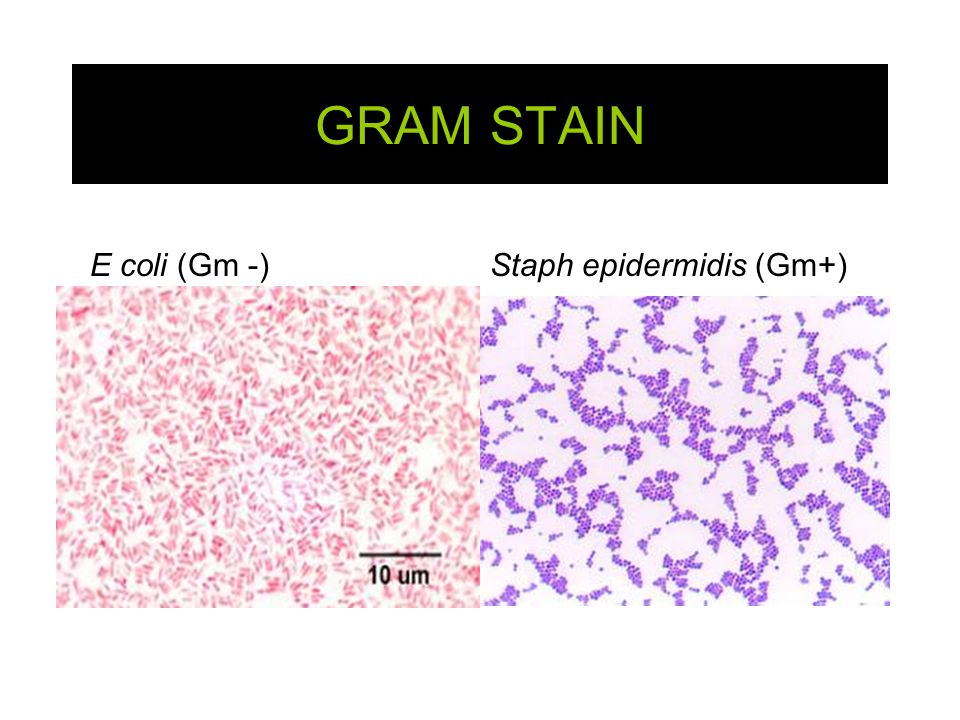 Staphylococcus Epidermidis Gram Stain