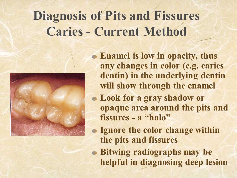 Diagnosis And Treatment Options Ppt Video Online Download