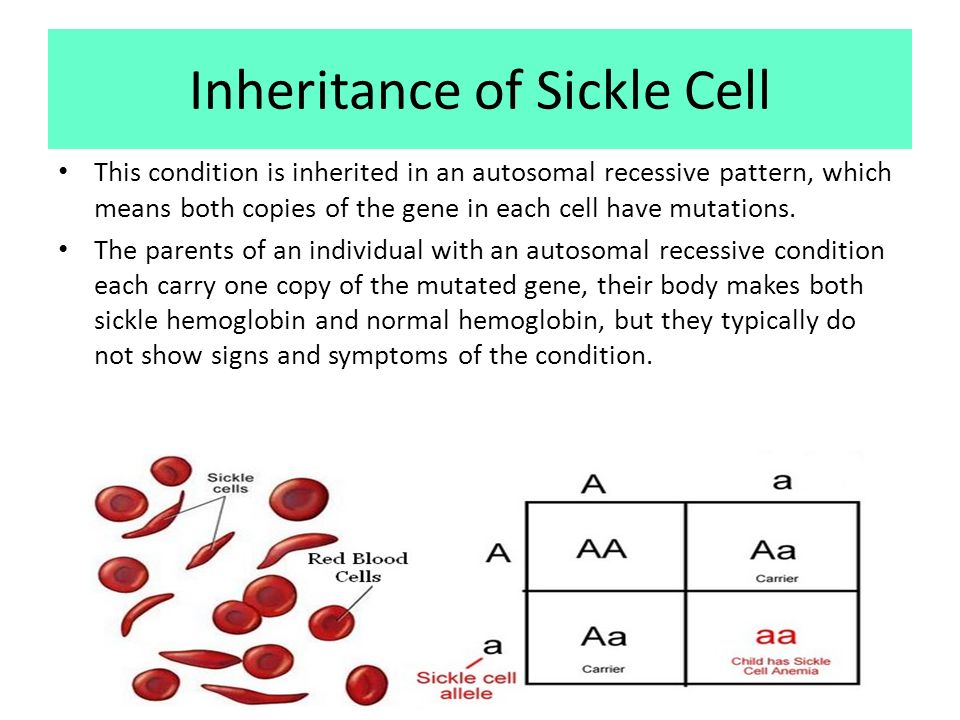 Sickle Cell Anemia Inheritance